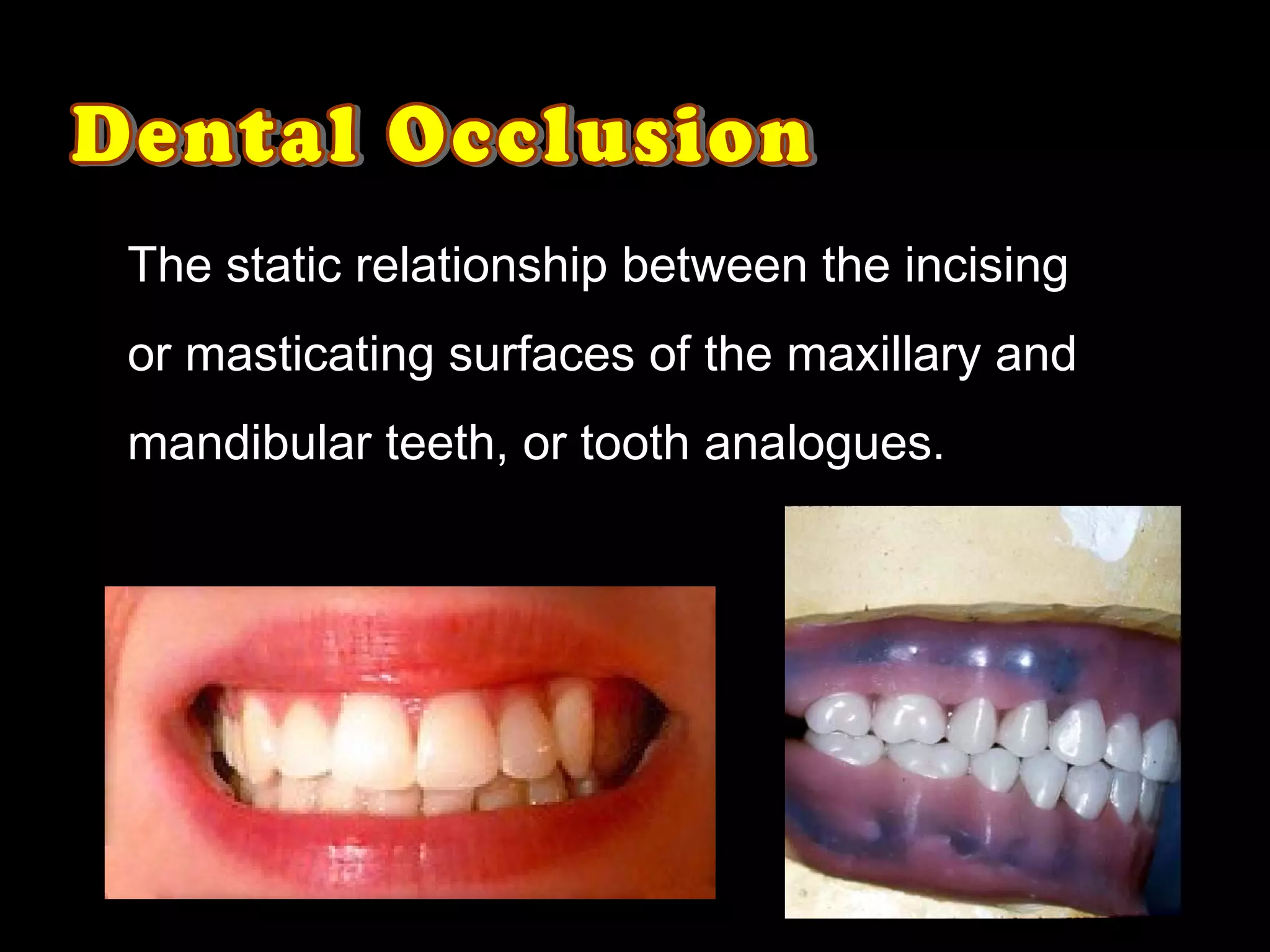 01 occlusion in prosthodontics introduction - stomatognathic system ...