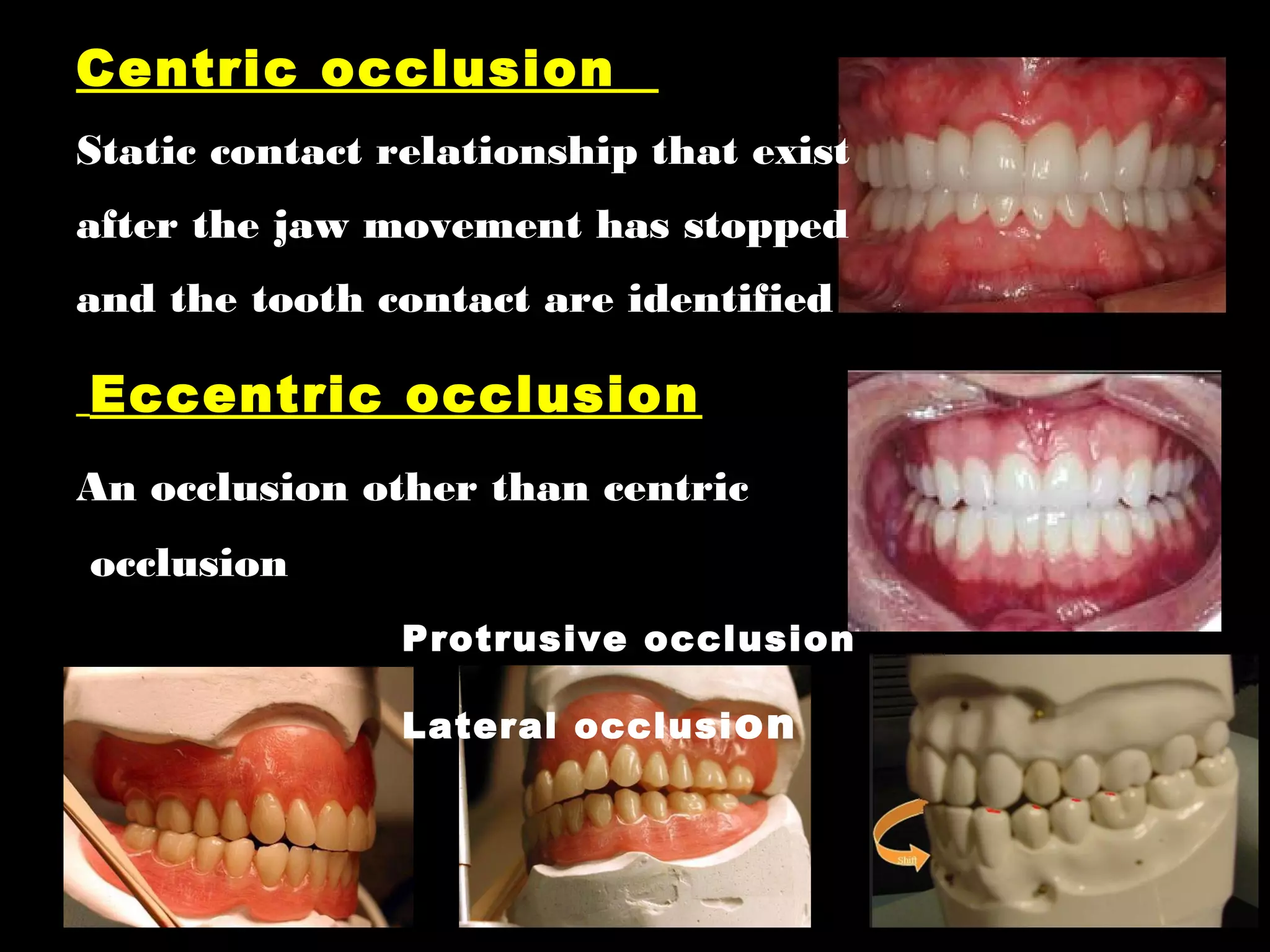 01 occlusion in prosthodontics introduction - stomatognathic system ...
