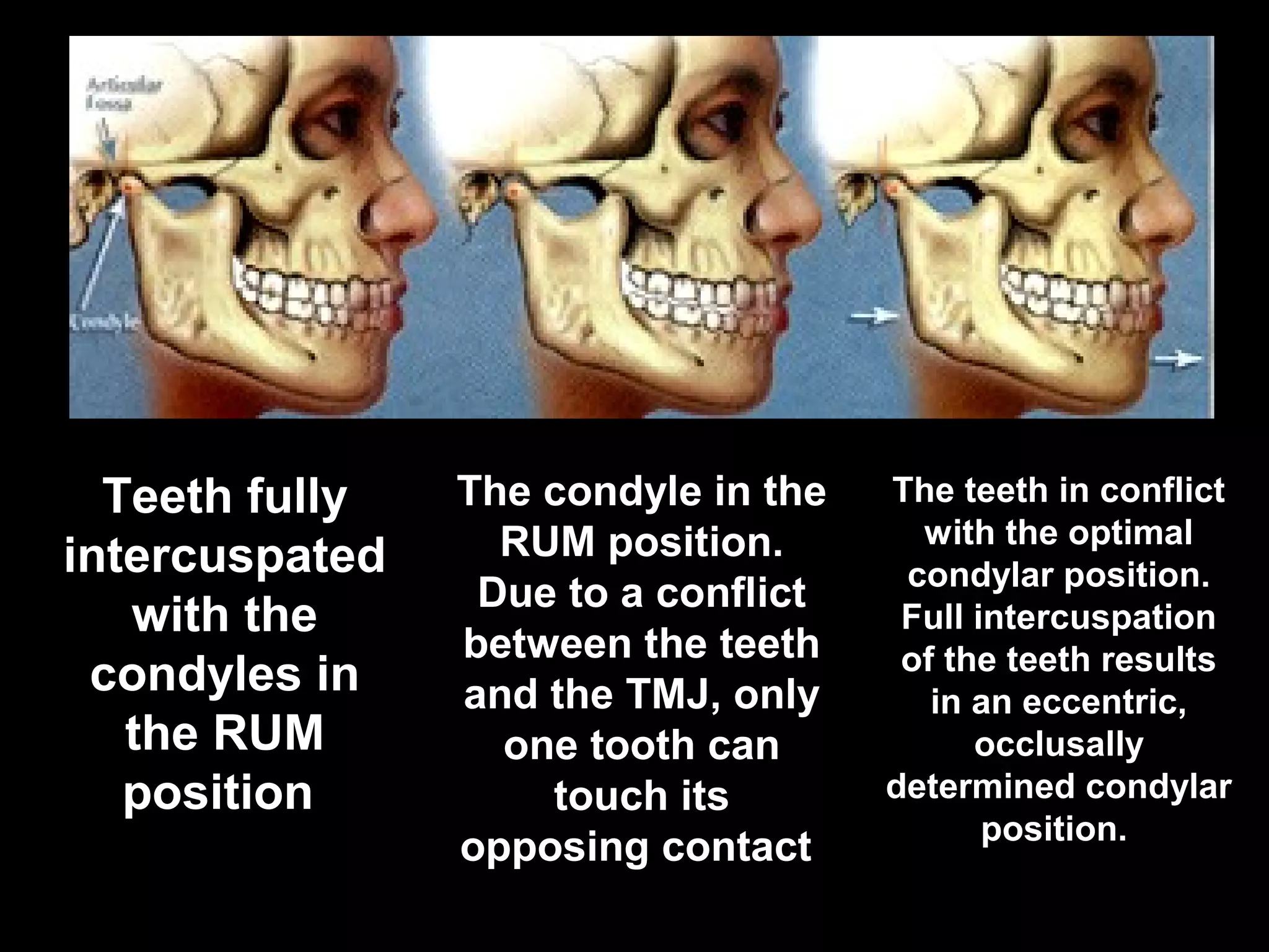01 occlusion in prosthodontics introduction - stomatognathic system ...