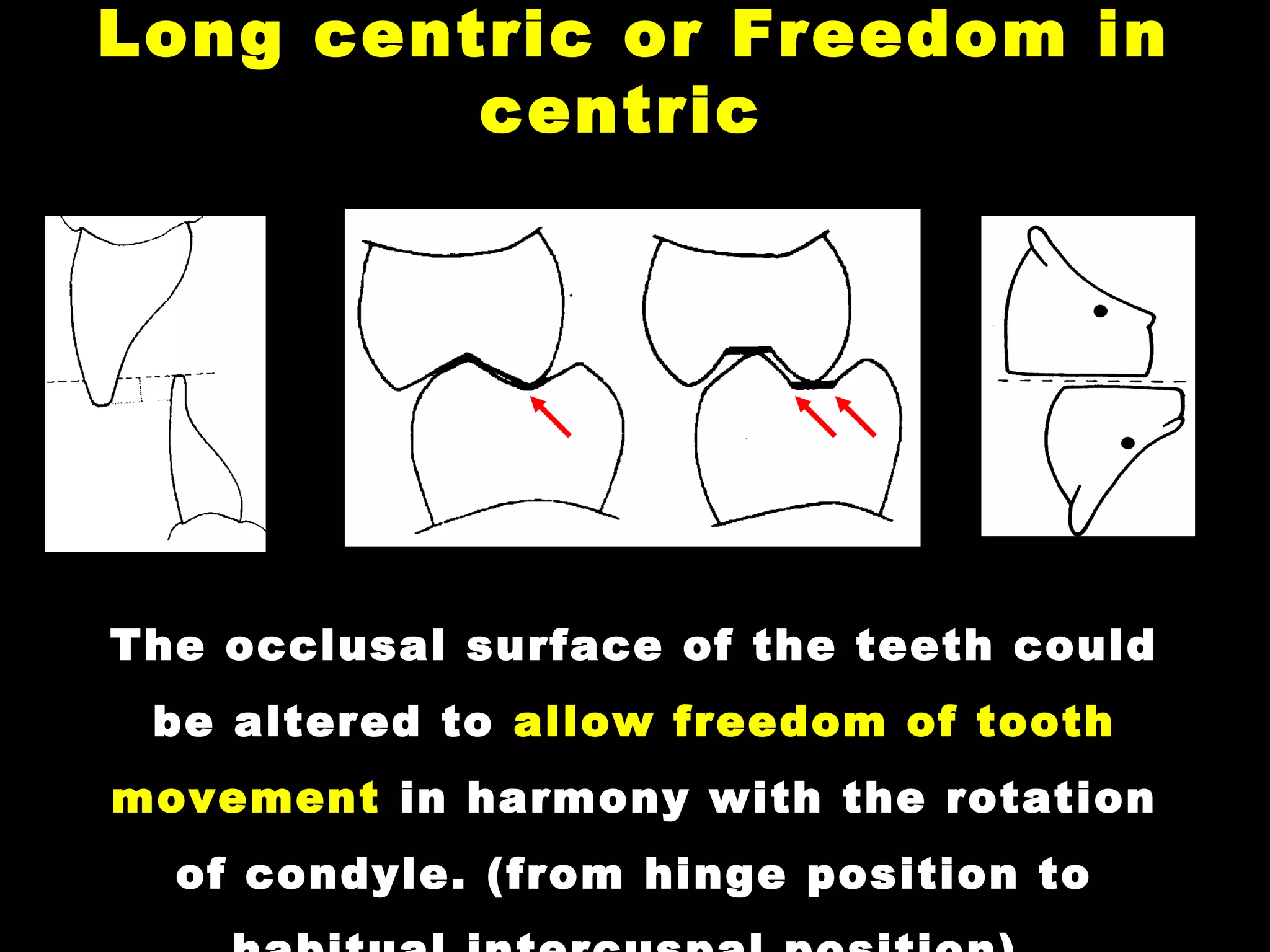 01 occlusion in prosthodontics introduction - stomatognathic system ...