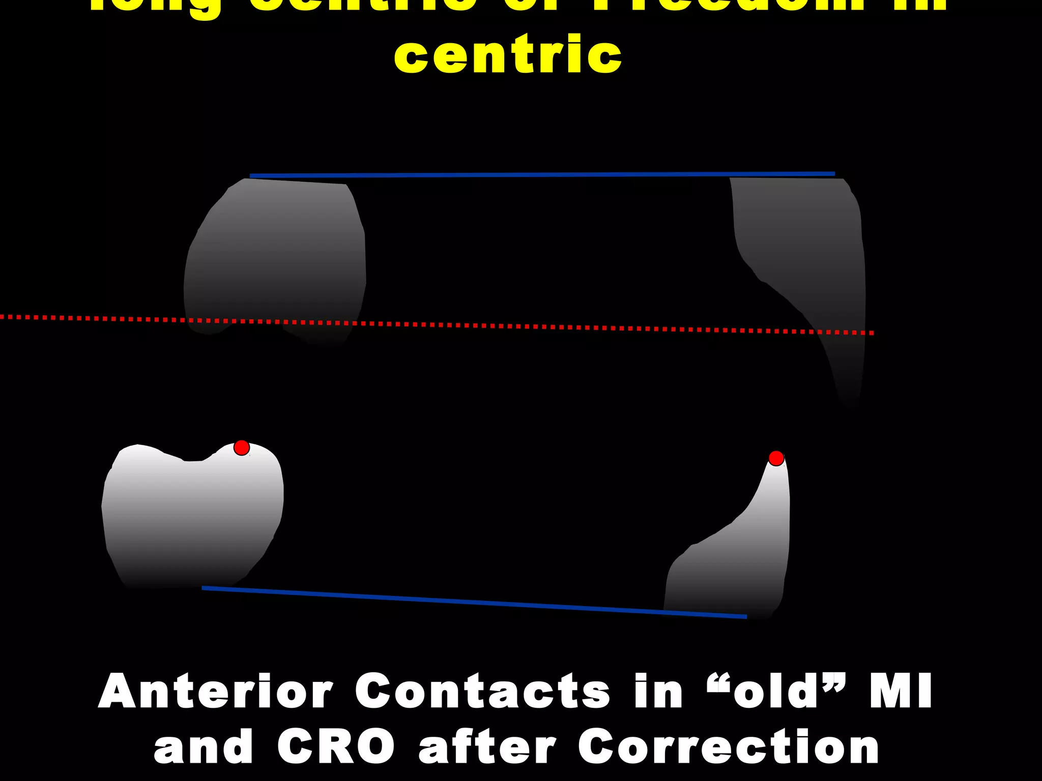 01 occlusion in prosthodontics introduction - stomatognathic system ...