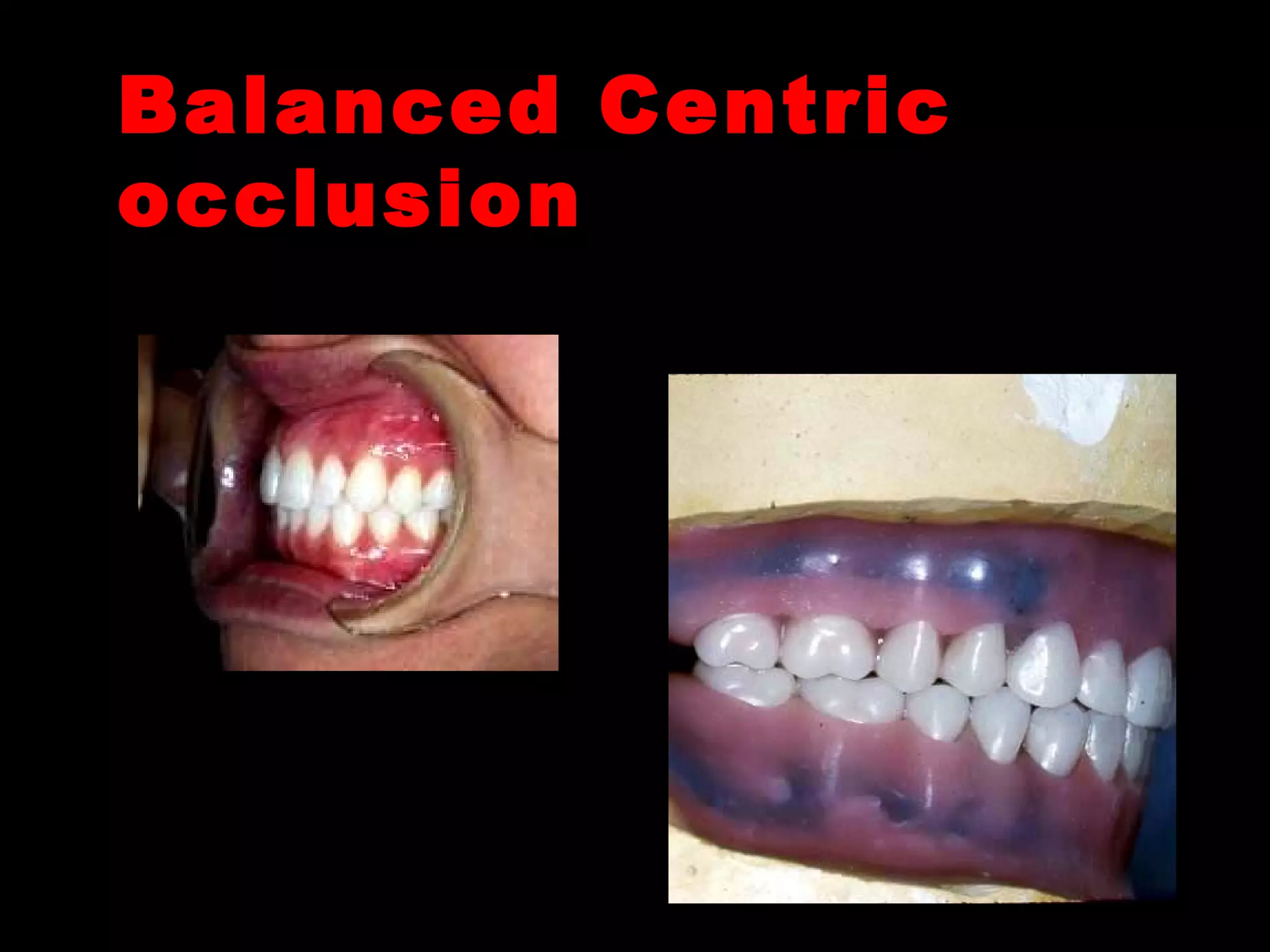 01 occlusion in prosthodontics introduction - stomatognathic system ...