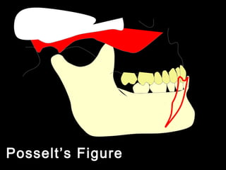 01 occlusion in prosthodontics introduction - stomatognathic system ...
