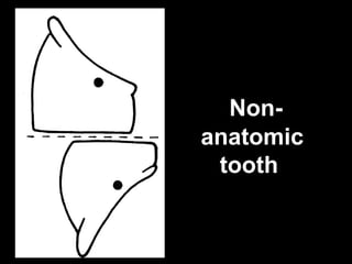 01 occlusion in prosthodontics introduction - stomatognathic system ...