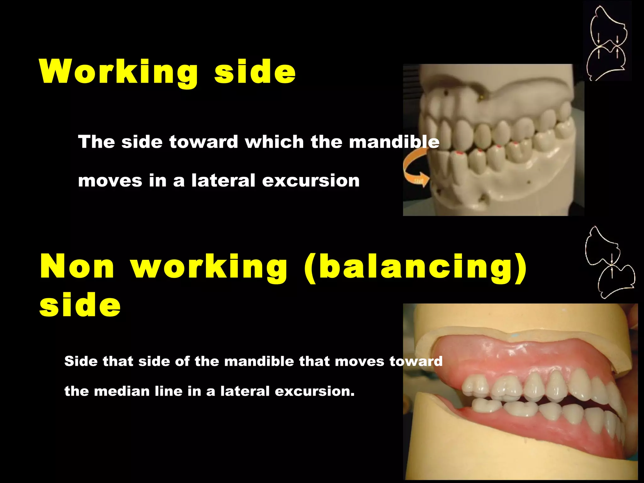 01 occlusion in prosthodontics introduction - stomatognathic system ...
