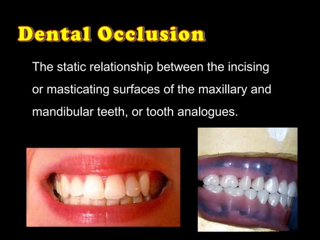 01 occlusion in prosthodontics introduction - stomatognathic system ...