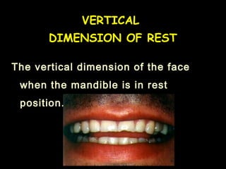 01 occlusion in prosthodontics introduction - stomatognathic system ...