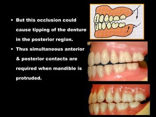01 occlusion in prosthodontics introduction - stomatognathic system ...