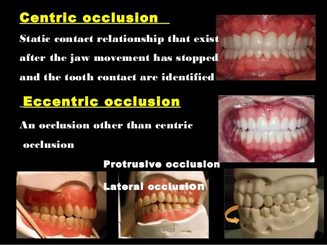 01 occlusion in prosthodontics introduction - stomatognathic system-