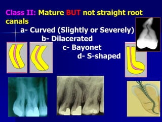01-pulp space morphology 3rd yegfhfar.pdf