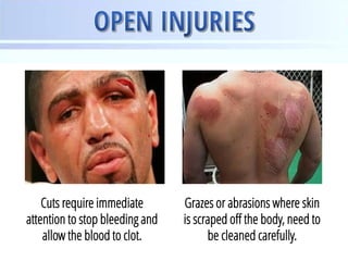 01-Sports-Injury-Management-and-Prevention-PPT.pdf