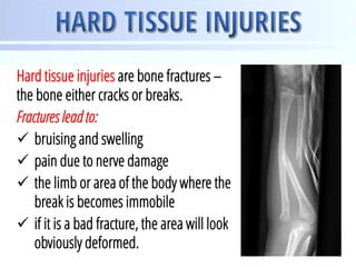 01-Sports-Injury-Management-and-Prevention-PPT.pdf