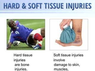 01-Sports-Injury-Management-and-Prevention-PPT.pptx