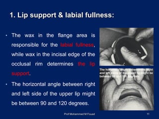 The Registration of Jaw Relations for Completely Edentulous Patient | PDF