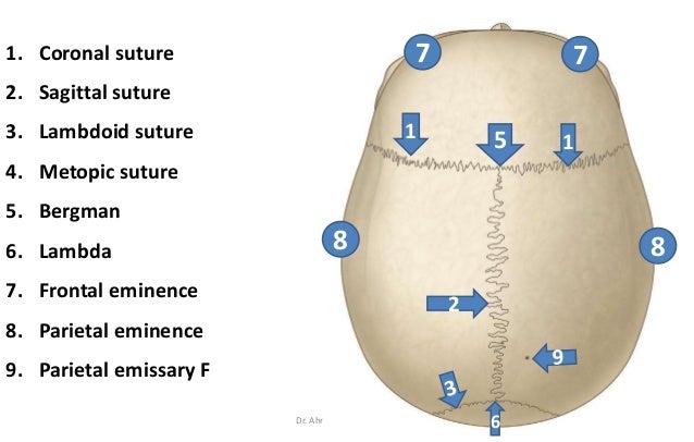 skeleton on head + bony features of norma verticalis + skull cap 2018