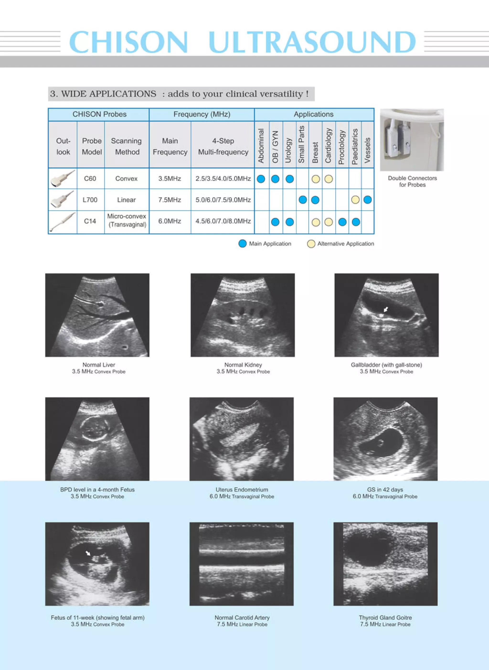 01002258 Chison 600 A | PDF