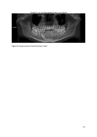 Supernumerary teeth(hyperdontia) | PDF