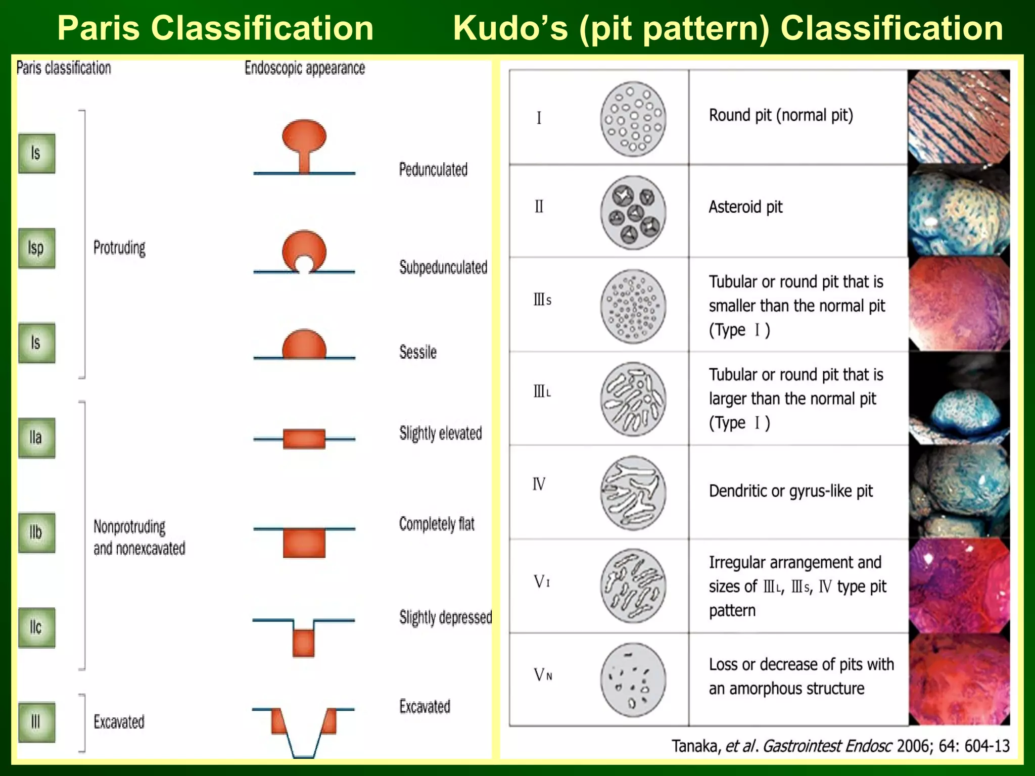Endoscopic methods of treatment of the "early" stomach and esophagus ...