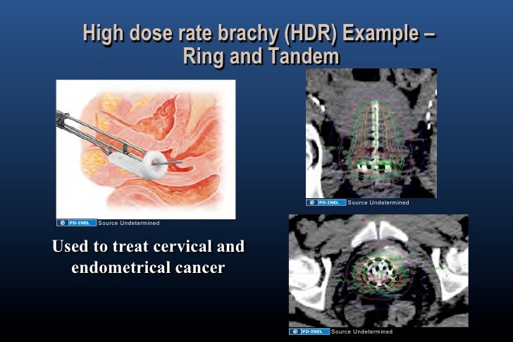 01.07.09(a): Introduction to Radiation Oncology, vPre-Clinical