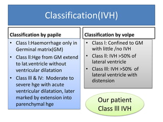 seminar intraventricular hemorrage and birth defects | PPT