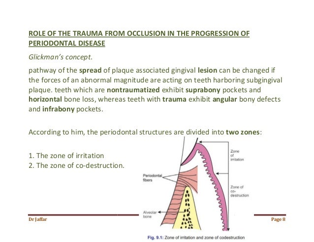 012.Trauma from Occlusion