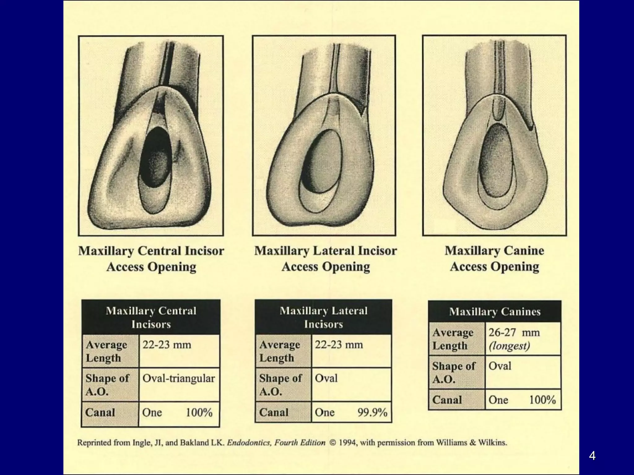 012. access cavity preparation | PPT