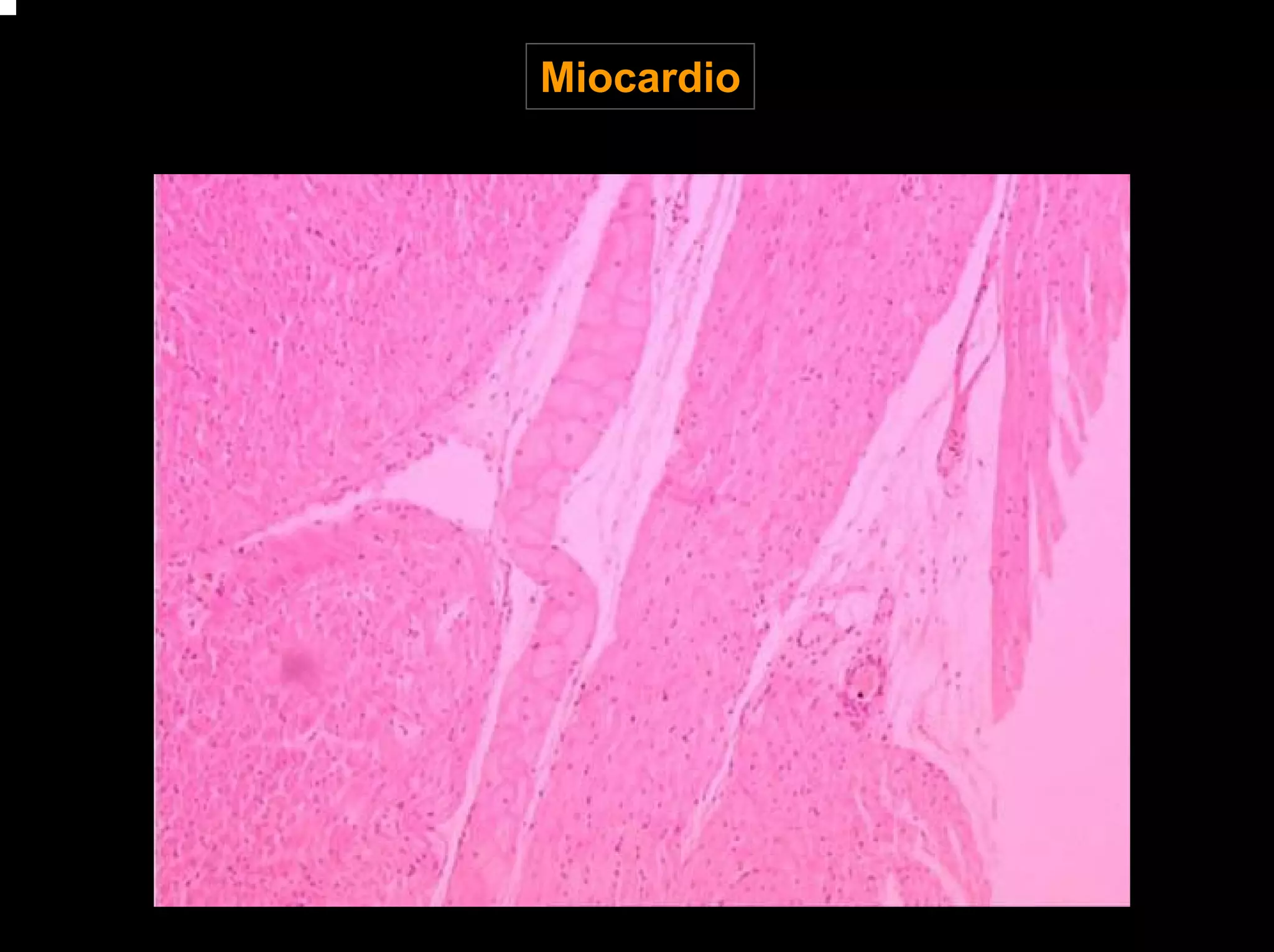 Histologia Corazón Pdf
