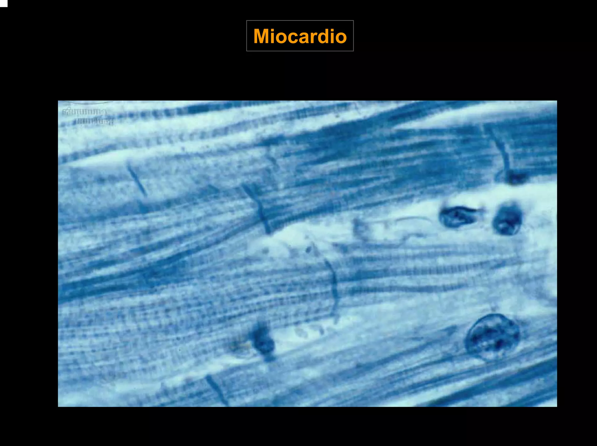 HISTOLOGIA corazón | PDF