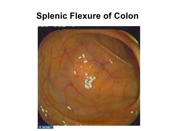 01.25.12: Introduction to M2 GI Sequence