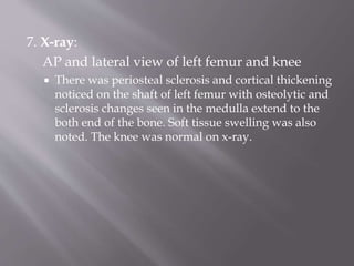 Osteomyelitis Case Presentation | PPTX