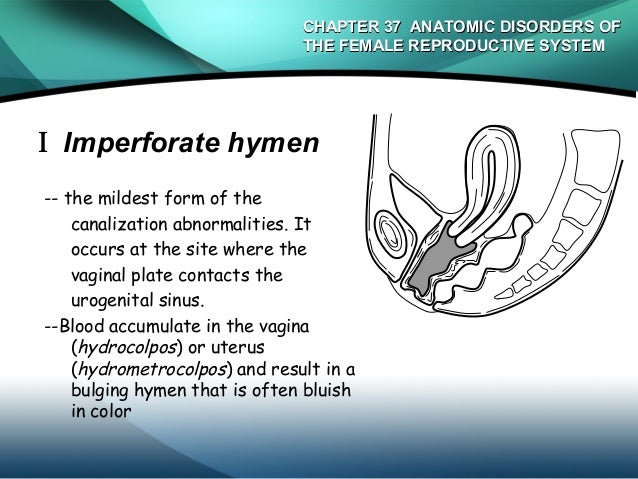 Female Hymen Anatomy