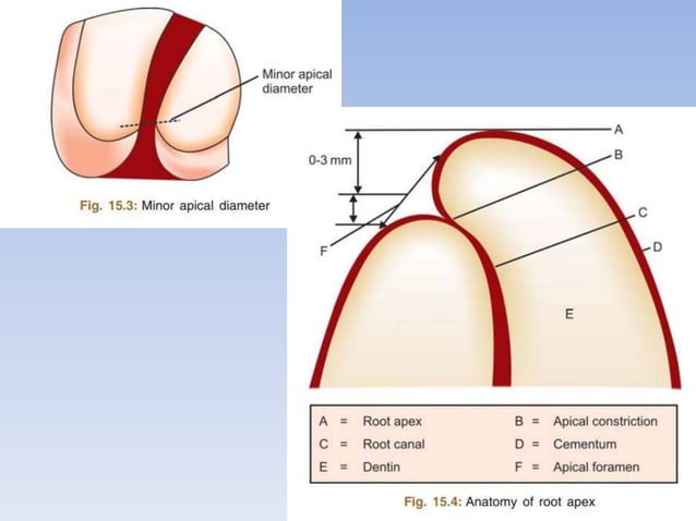 013 Working Length Determination Pptx