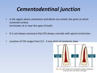 013.working length determination | PPTX