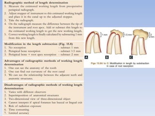 013.working length determination | PPTX