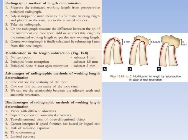 013.working length determination | PPTX