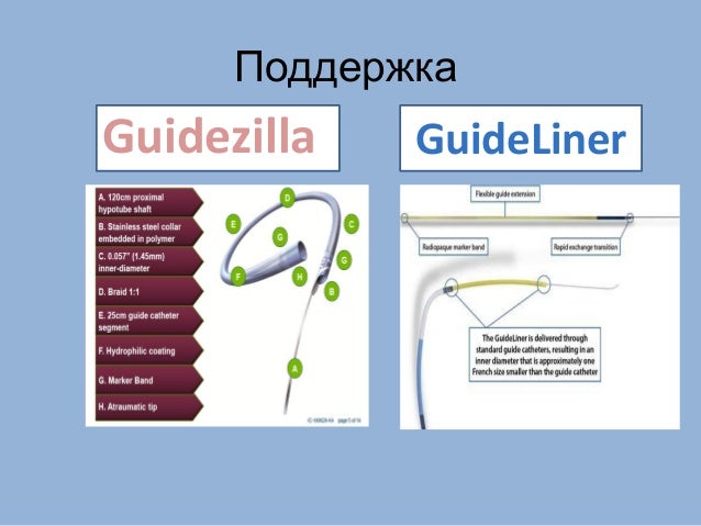 Guideliner Vs Guidezilla