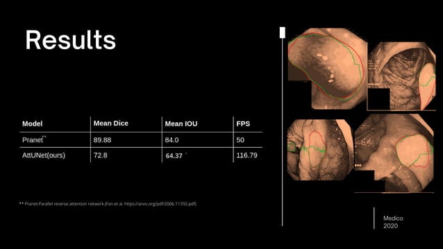 Fine-tuning for Polyp Segmentation with Attention | PDF | Technology & Computing