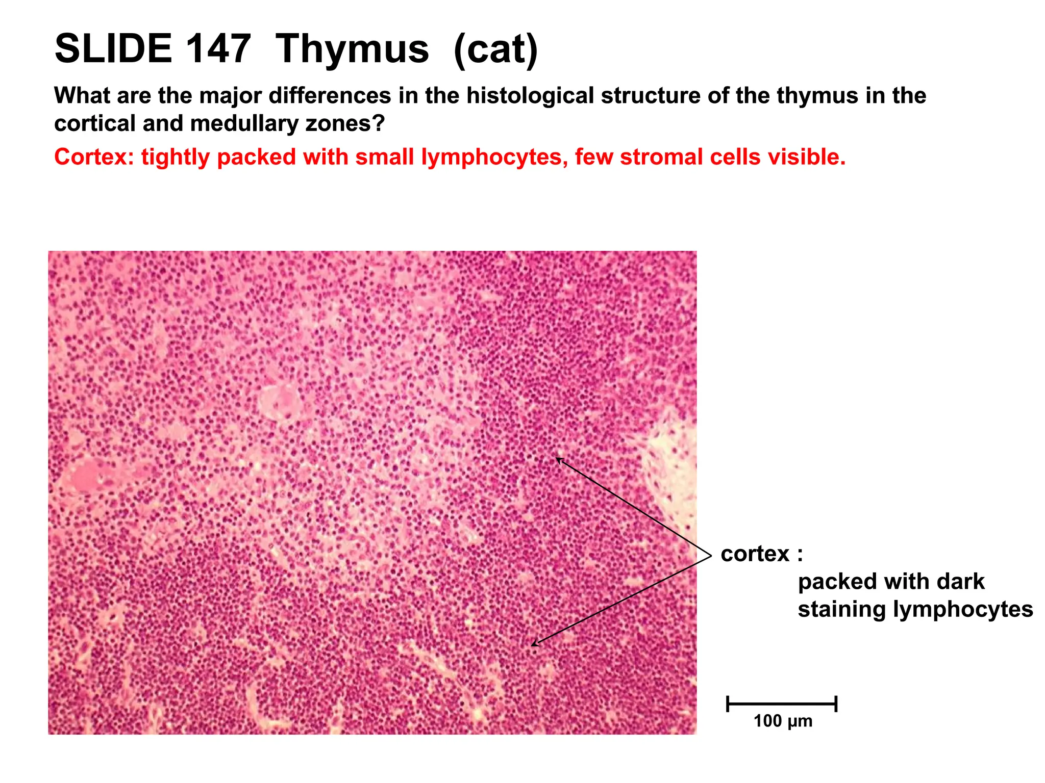 LYMPHOID TISSUE a histological perspective .ppt