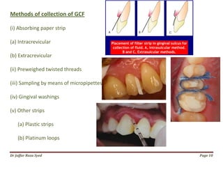 018.defense mechanisms of gingiva | PDF