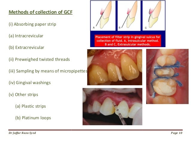 018.defense mechanisms of gingiva