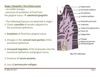 019.gingival diseases | PDF