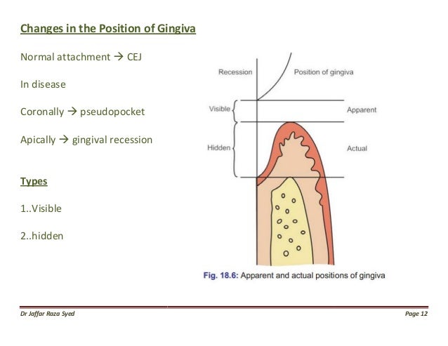 アクチュアルポジション (アクチュアルポジション) - Japanese-English Dictionary - JapaneseClass.jp