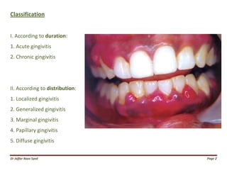 019.gingival diseases | PPT