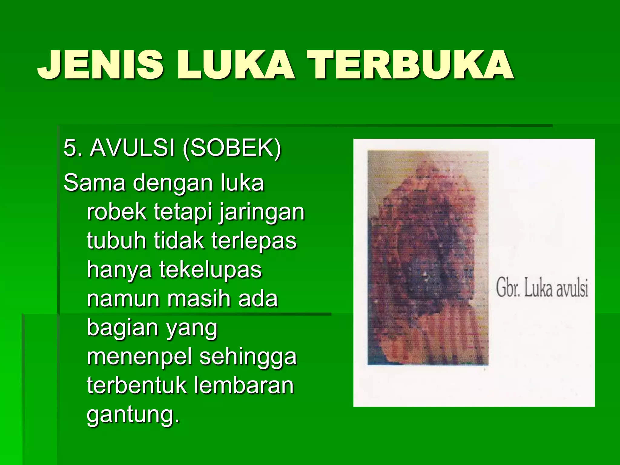 Pertolongan Pertama (P3K) | PPTX