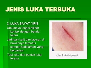 Pertolongan Pertama (P3K) | PPT