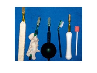 Comprehensive Overview of Down Syndrome: Clinical Features, Dental Care ...