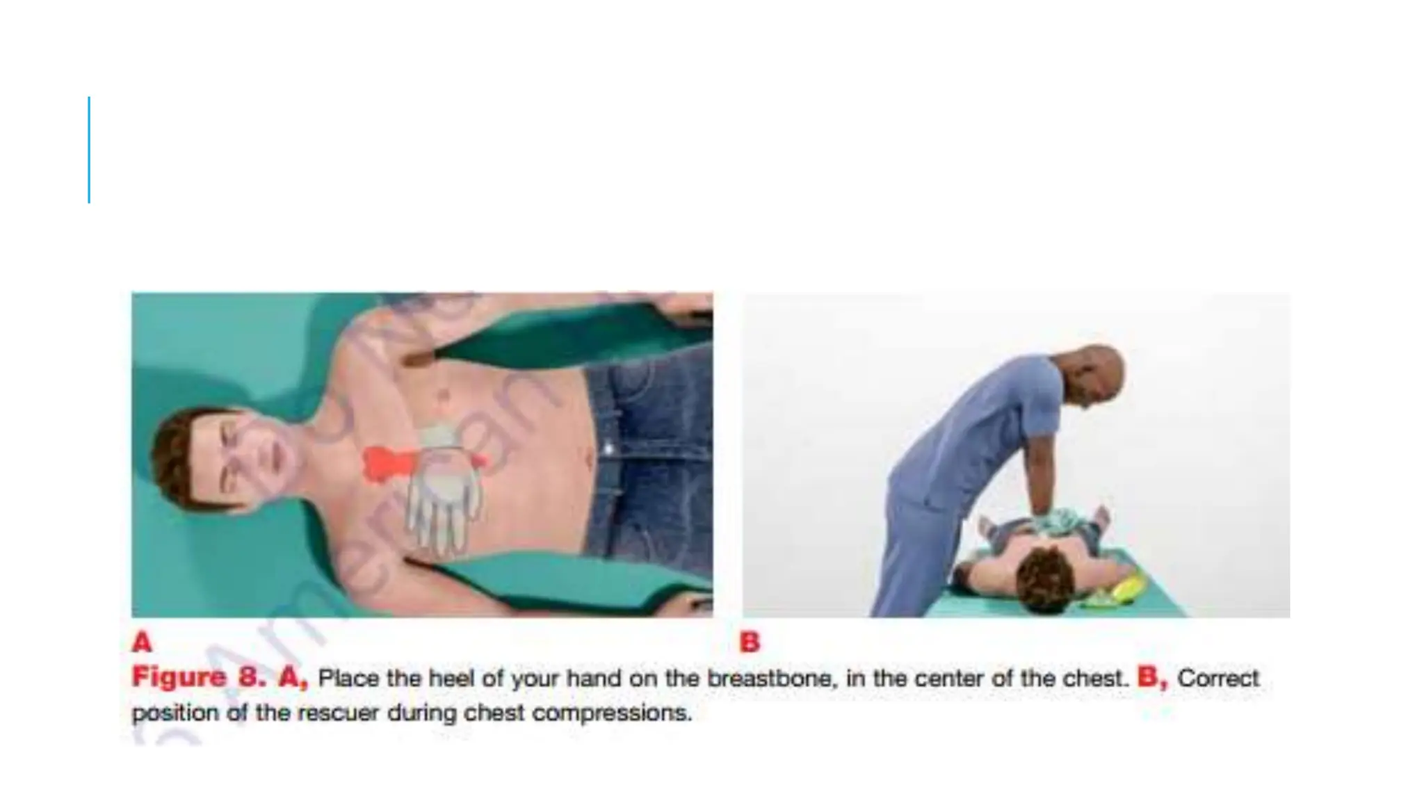 01 Basic Life Support Clinical -Part-1.pptx