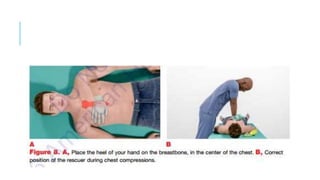 01 Basic Life Support Clinical -Part-1.pptx