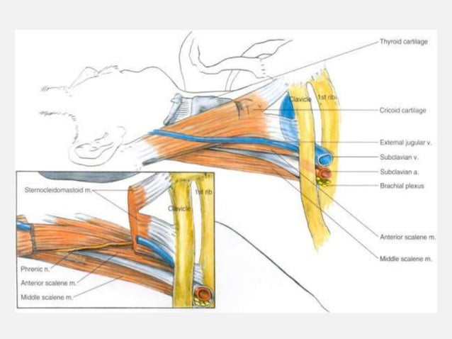 brachial plexus blocks | PPTX