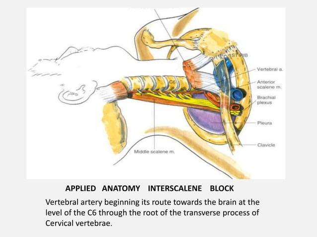 brachial plexus blocks | PPTX